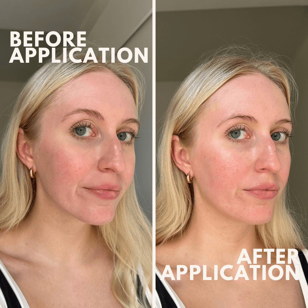 Before and after using Kukui Nut Rescue Oil on skin.