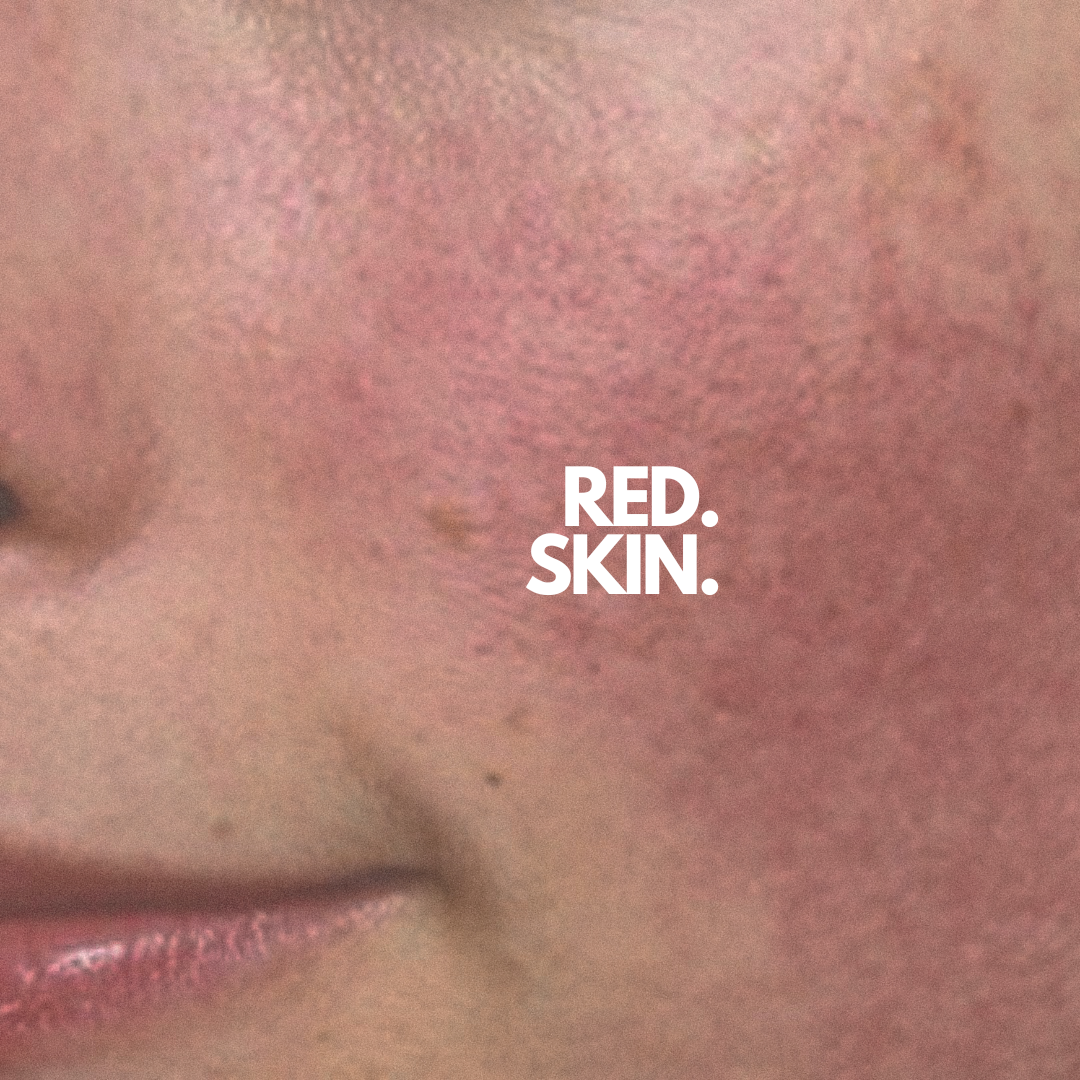 Smooth Powder Skincare | Clean beauty | Yui Skin